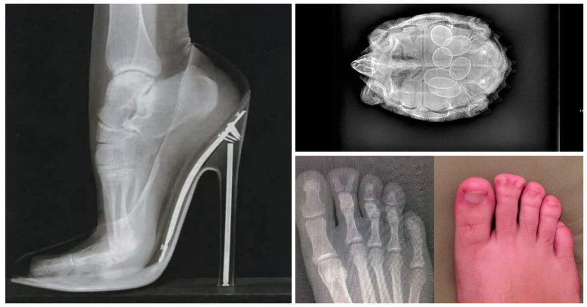 These 35 Bizarre X-Rays Will Make You Scratch Your Head in Wonder ...
