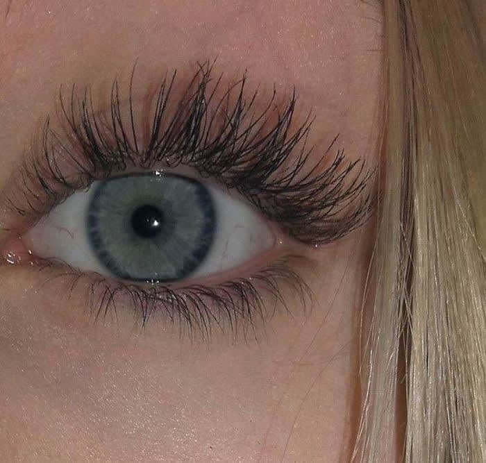 People With Rare Genetics That Make Them Unique Kueez