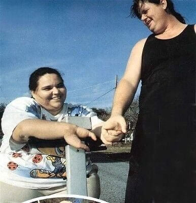 The Eerily Mysterious Life of Tarrare: The Man Who Couldn't Stop Eating ...